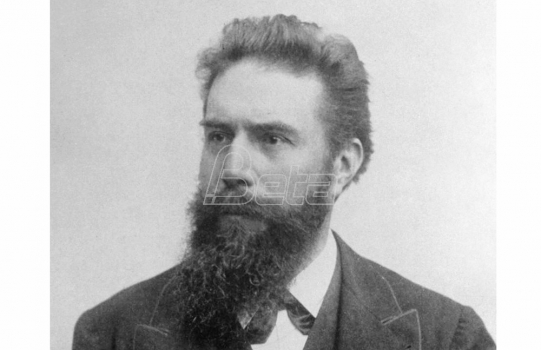 Si sot, më 5 janar, u zbuluan rrezet X nga Rentgen - JavaNews.al